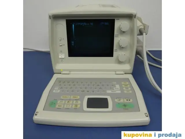 Ultraschallgerät Kretz Sonos Ace SA 600