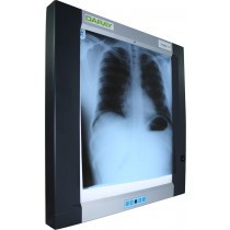 Daray Single Panel X-Ray Viewer