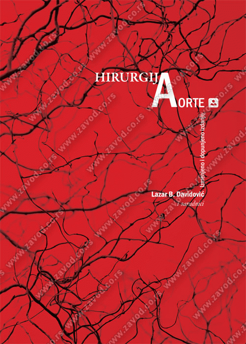 Hirurgija aorte