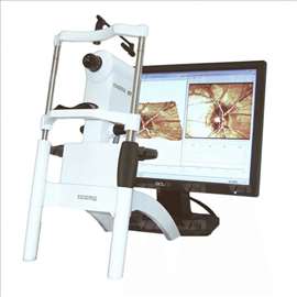 Laser HRT 2 Heidelberg Retinal Tomography
