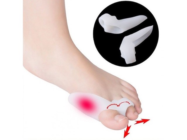 Silikonski korektor za čukljeve - hallux valgus