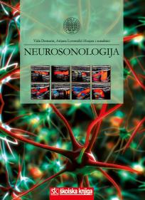 Neurosonologija