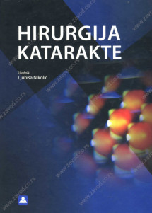 HIRURGIJA KATARAKTE