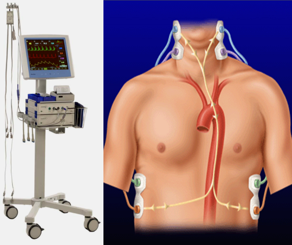 Pregled srca Cardioscreen aparatom