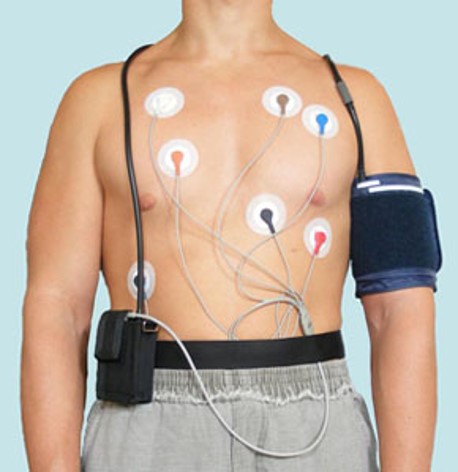 Holter EKG