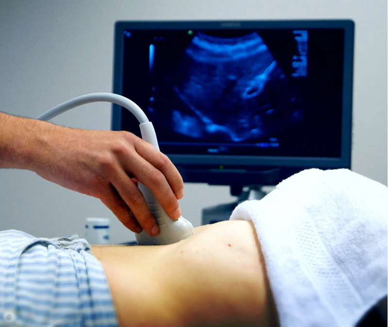 Ultrazvuk male karlice