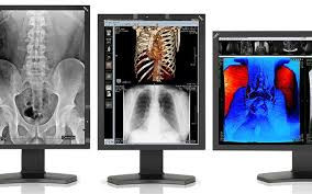 NEC 21" Color Medical Diagnostic Monitors with MDA-W5000 Graphics Card