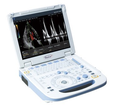 Fokuda portabilni ultrazvuk-超音波画像診断装置 UF-760AG＋ PaoLus＋