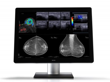 FX11 Medicinski monitor