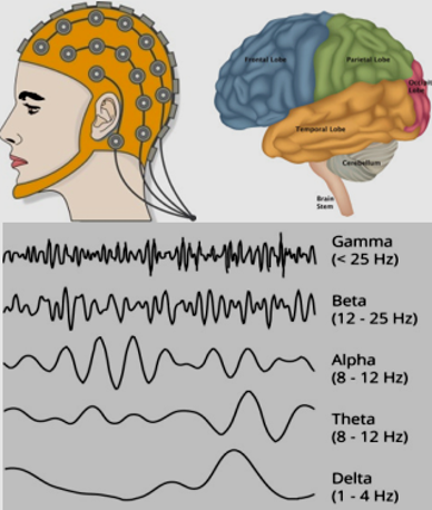 Elektroencefalografija – EEG
