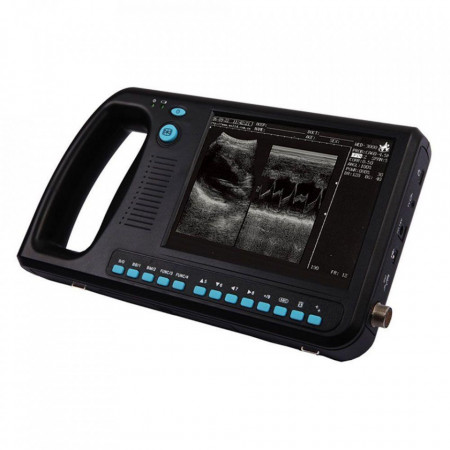 Ultrasound Machine | WD-300 Kardiologija ultrazvuk