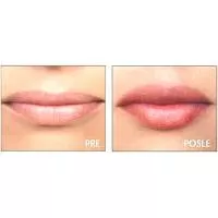 Perfect Pout SKIN DOCTORS (8ml)