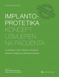 Implantoprotetika: Koncept usmjeren na pacijenta