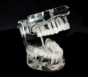 Model stomatoloških implatanata