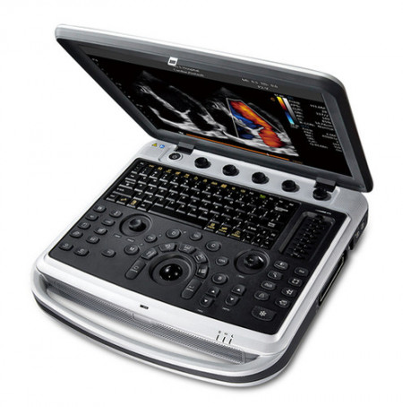 Chison Sonobook9 portable ultrasound machine
Chison Sonobook 9.portable ultrasound machine