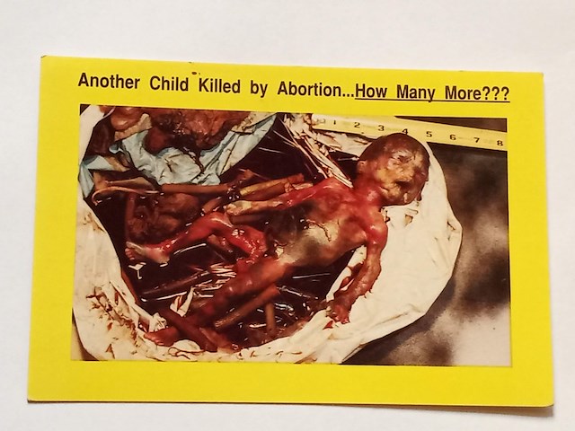 Još Jedno Dete Ubijeno Abortusom - Čista -