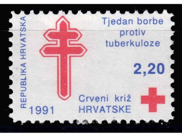 TUBERKULOZA HRVATSKA 1991