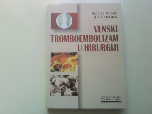 Venski tromboembolizam u hirurgiji