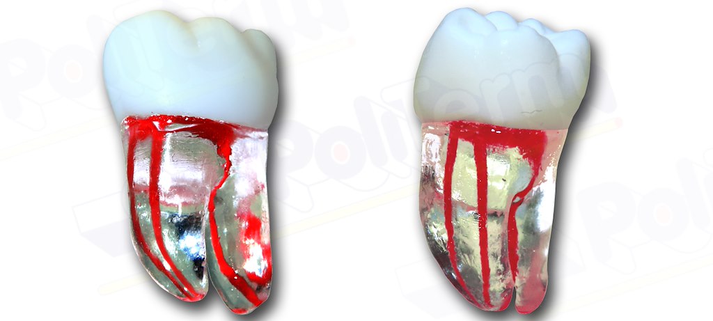 Donji molar – stomatološki model zuba za vežbu
