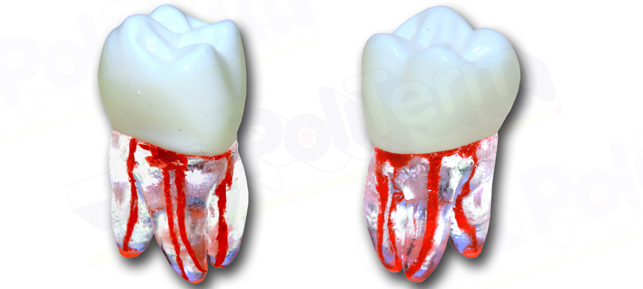 Gornji molar – stomatološki model zuba za vežbu