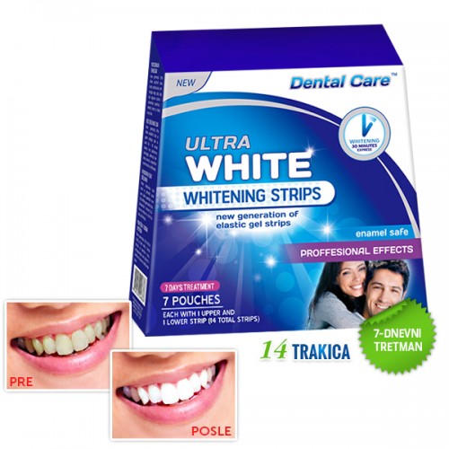 ULTRA WHITE Trake za izbeljivanje zuba – 7 dnevni tretman (14 trakica)