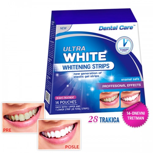 ULTRA WHITE Trake za izbeljivanje zuba – 14 dnevni tretman (28 trakica)