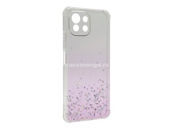 Futrola za Xiaomi Mi 11 Lite/5G/Youth Simple sparkle roza