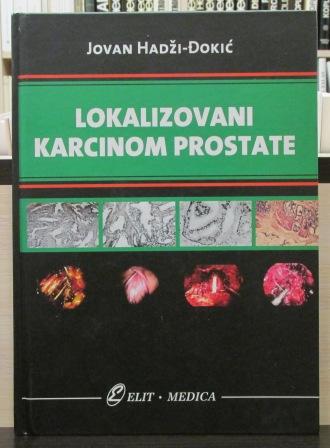 LOKALIZOVANI KARCINOM PROSTATE – JOVAN HADŽI-ĐOKIĆ