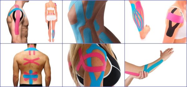 Kinezi trake – Kinesio tape