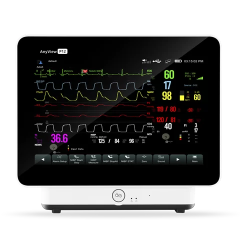 Biolight® P serija pacijent monitori
