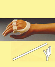 ORF.1.2. ULNARNI SPLINT