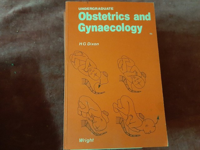 502 Undergraduate Obstetrics and Gynaecology H G Dixon