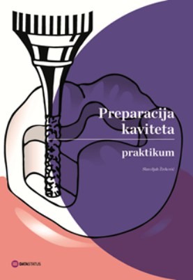 Preparacija kaviteta - praktikum