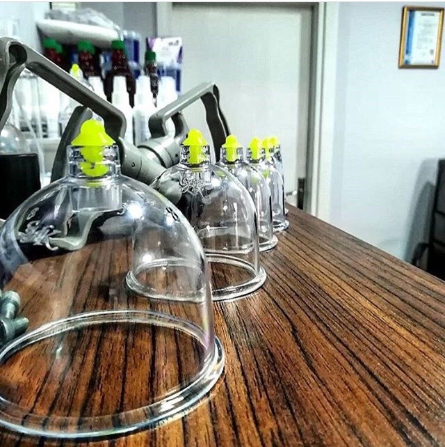 Cupping set – gold
24 ventuze + 2 pištolja (3 bara i 3.5 bara)