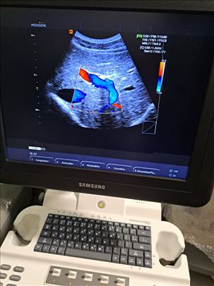 Ultrazvuk -ultrazvucni aparat