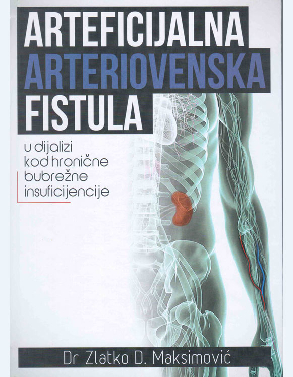 Arteficijalna arteriovenska fistula
