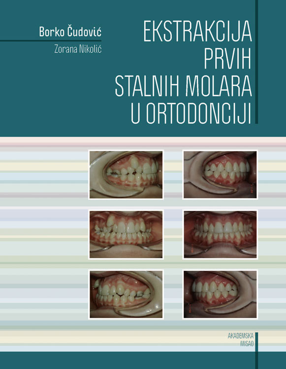 EKSTRAKCIJA PRVIH STALNIH MOLARA U ORTODONCIJI