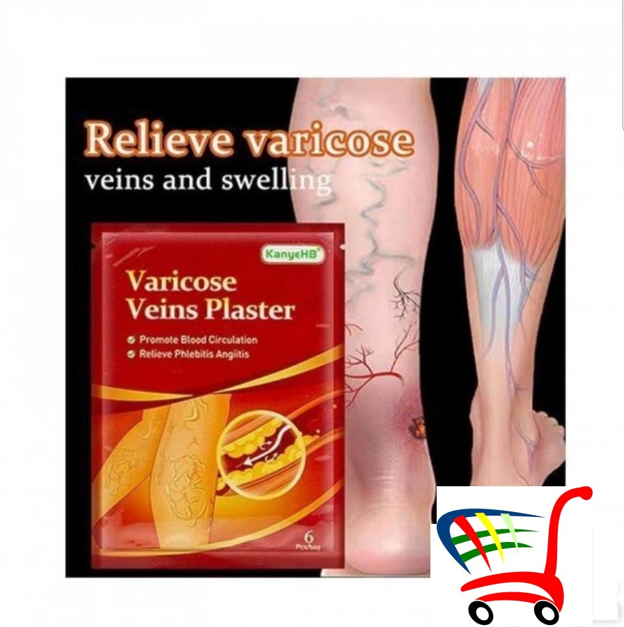 Flasteri za vene – Flasteri za prosirene vene 6 komada – Flasteri za vene – Flasteri za prosirene vene 6 komada