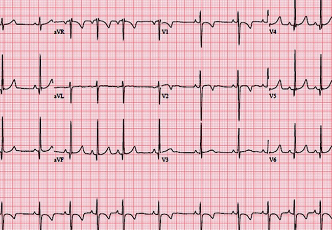 Kardiološki pregled i EKG