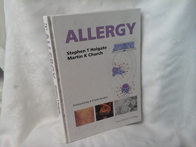 Allergy Stephen Holgate Martin Church Alergije