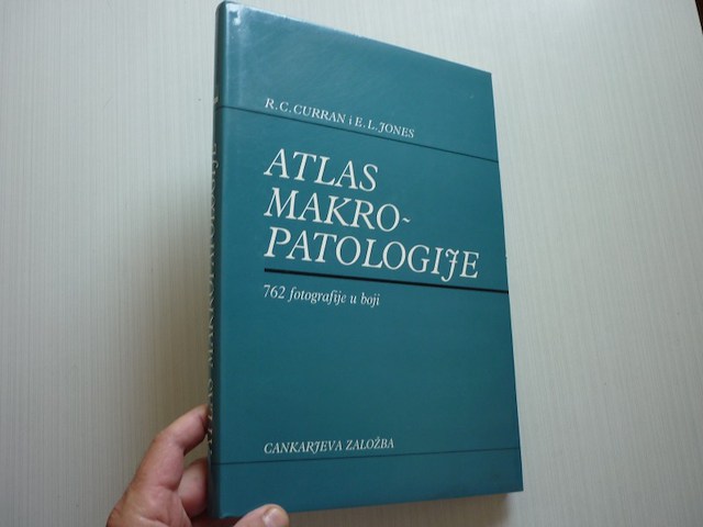 Atlas makropatologije