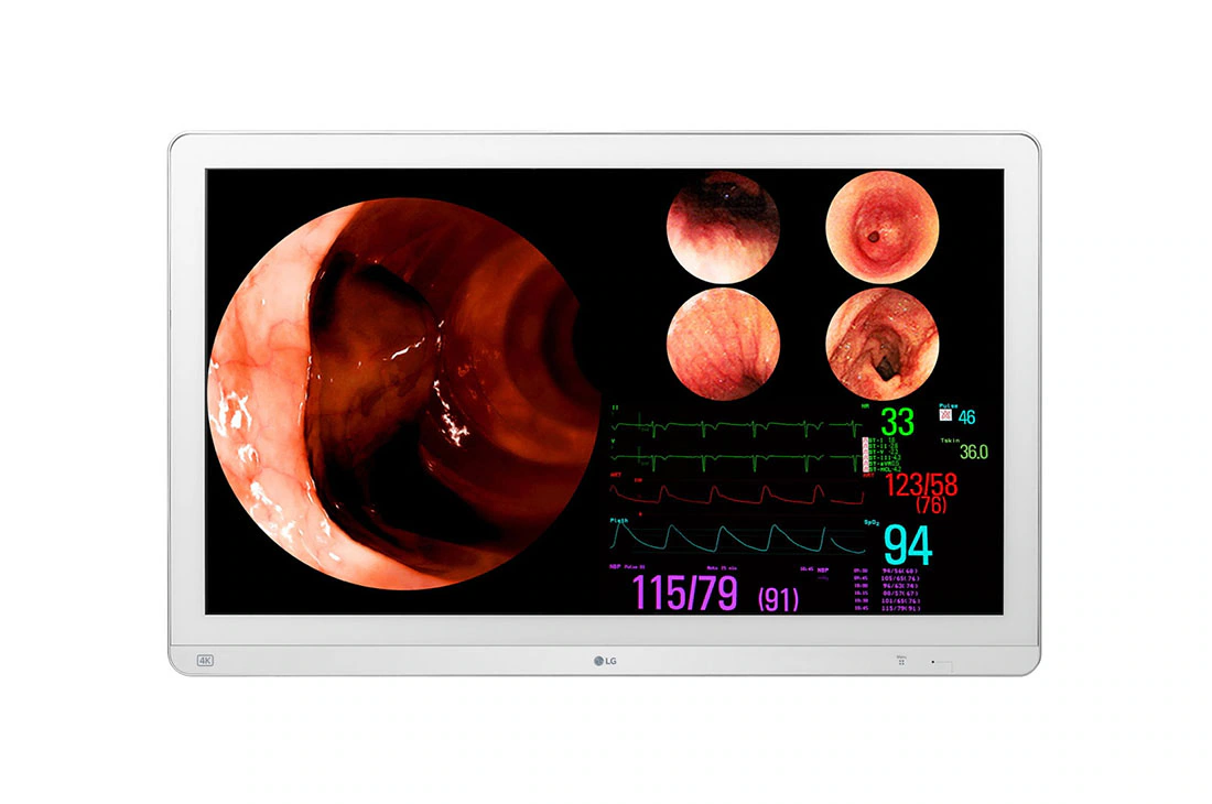LG 31.5'' 4K IPS hirurški monitor