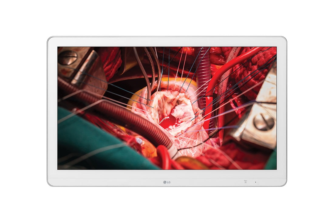 LG 27'' Full HD hirurški monitor