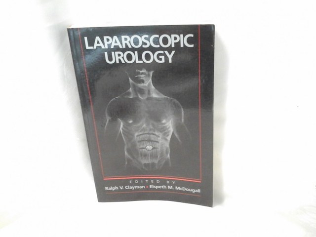 Laparoscopic urology Ralph Clayman laparoskopija
