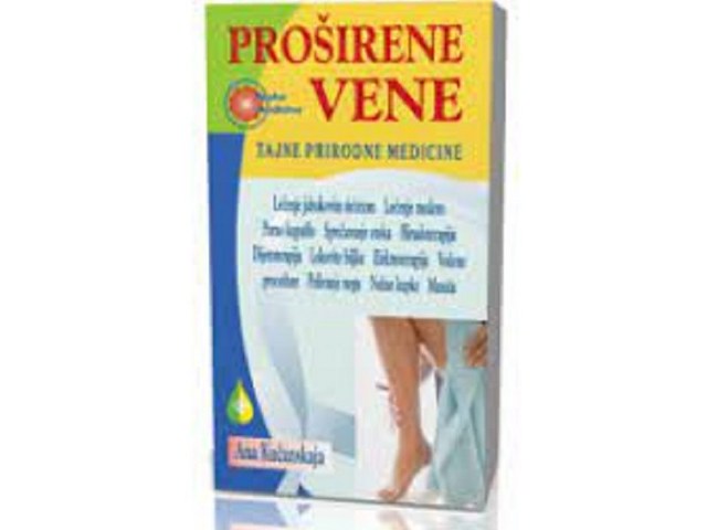 Proširene vene - Ana Kučanskaja