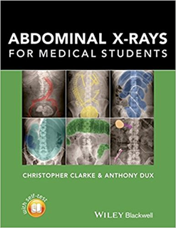 Abdominal X-Rays Medical Students