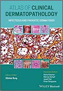 Atlas of Clinical Dermatopathology Infectious and Parasitic Dermatoses