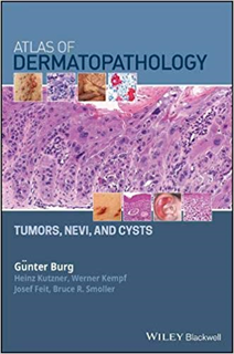 Atlas Of Dermatopathology Tumors & Cysts