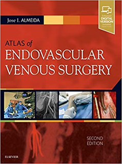 Atlas of Endovascular Venous Surgery