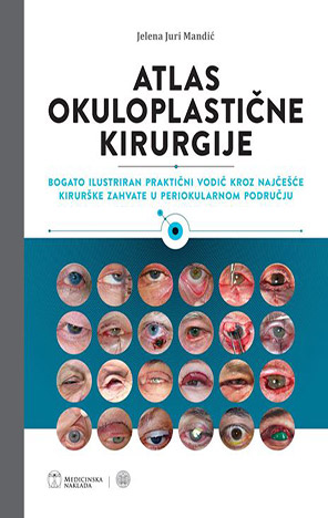 Atlas Okuloplastične Kirurgije